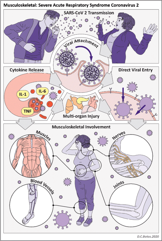 Is COVID-19 Causing Your Joint Pain? - iOrtho - The Orthopedic Institute