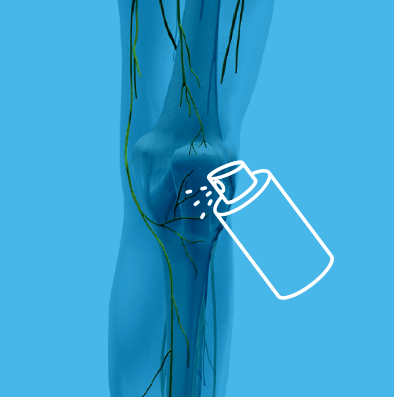 iovera° Treatment - Staten Island and NYC | iOrtho